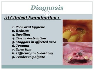 Oral Myiasis | PPTX