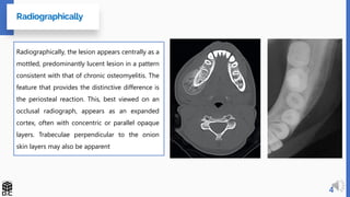Oral Patho Lec.5 Inflammatory Bone Diseases P.1.pdf