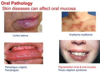 Oral pathology dr faeza | PPT