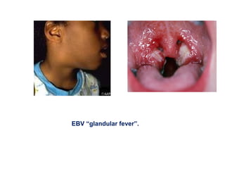 Oral pathology dr faeza | PPT