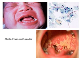 Oral pathology dr faeza | PPT