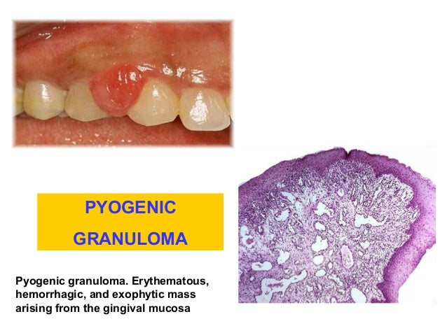 Oral pathology dr faeza