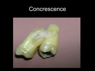 Oral pathology | PDF