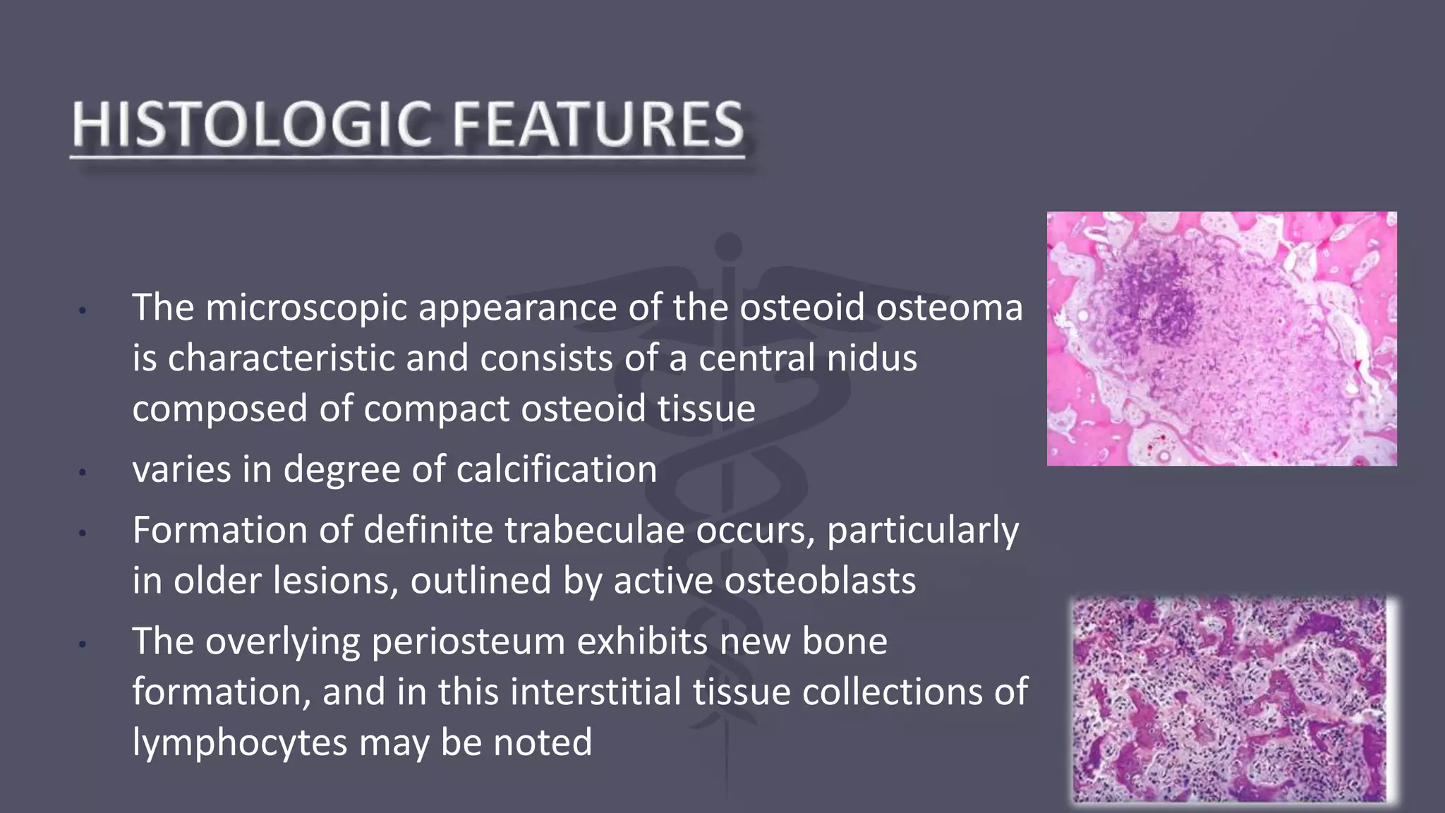 Oral pathology osteoma,chondroma,myxoma | PPTX