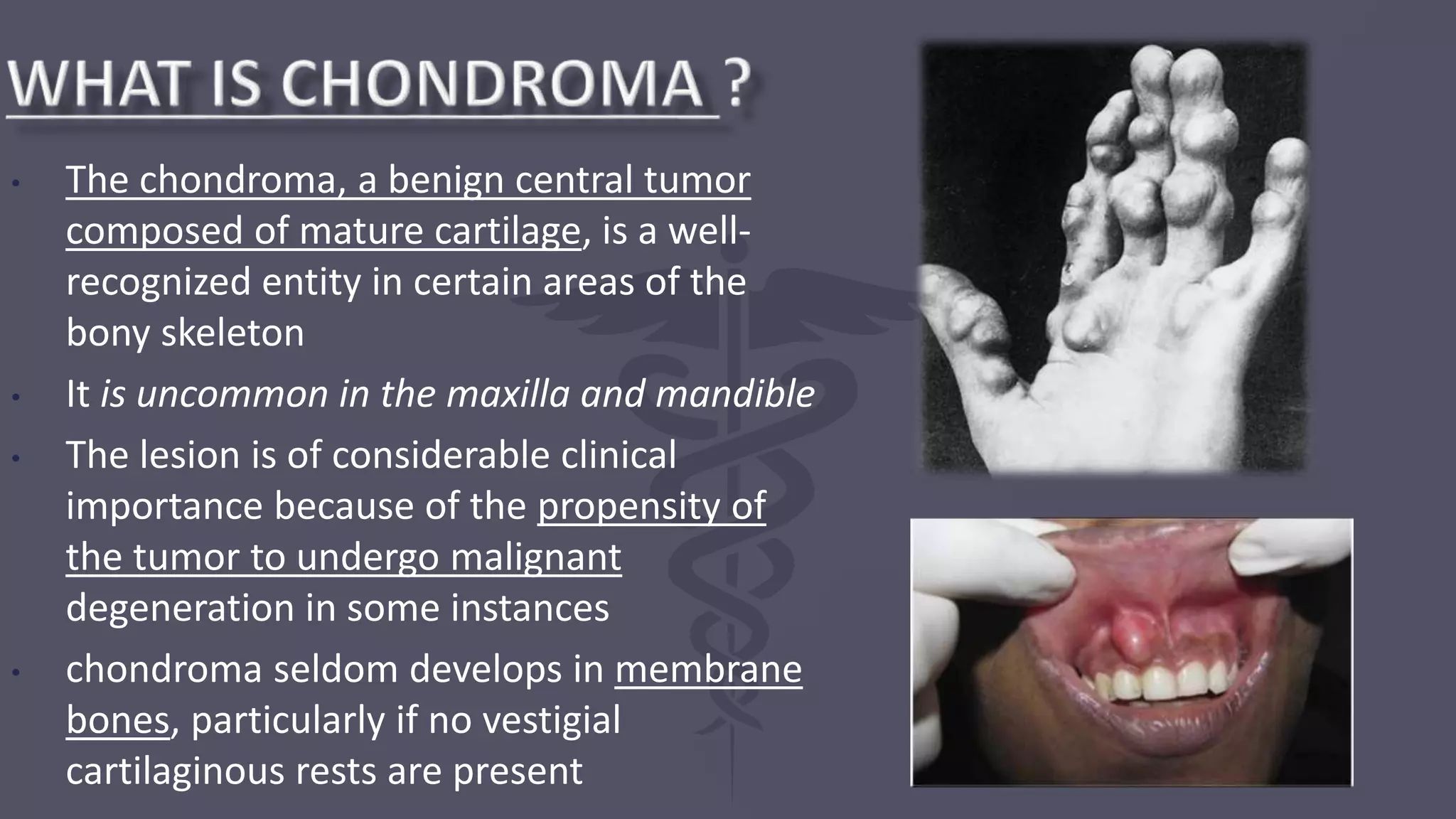 Oral pathology osteoma,chondroma,myxoma | PPTX