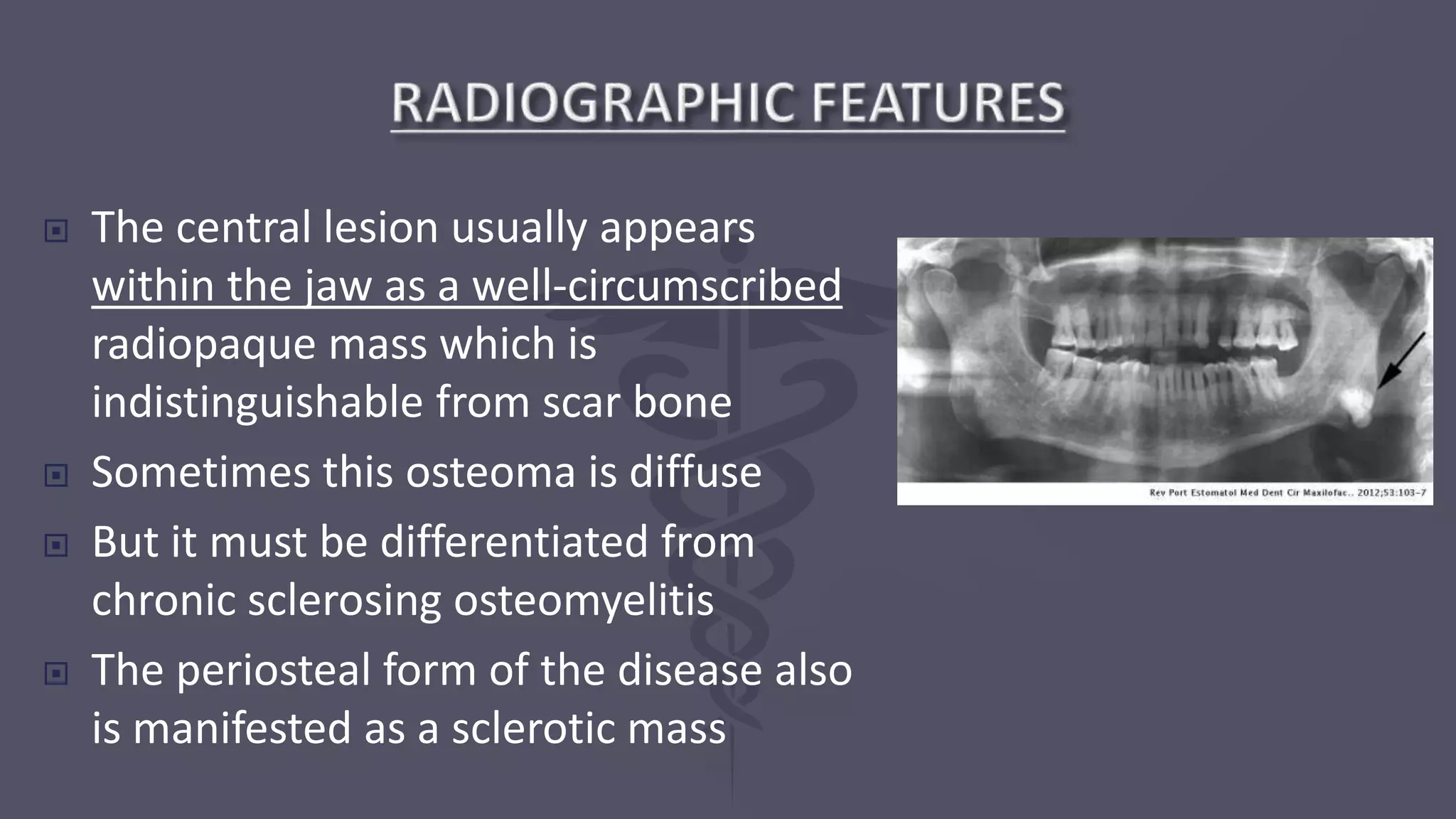 Oral pathology osteoma,chondroma,myxoma | PPTX