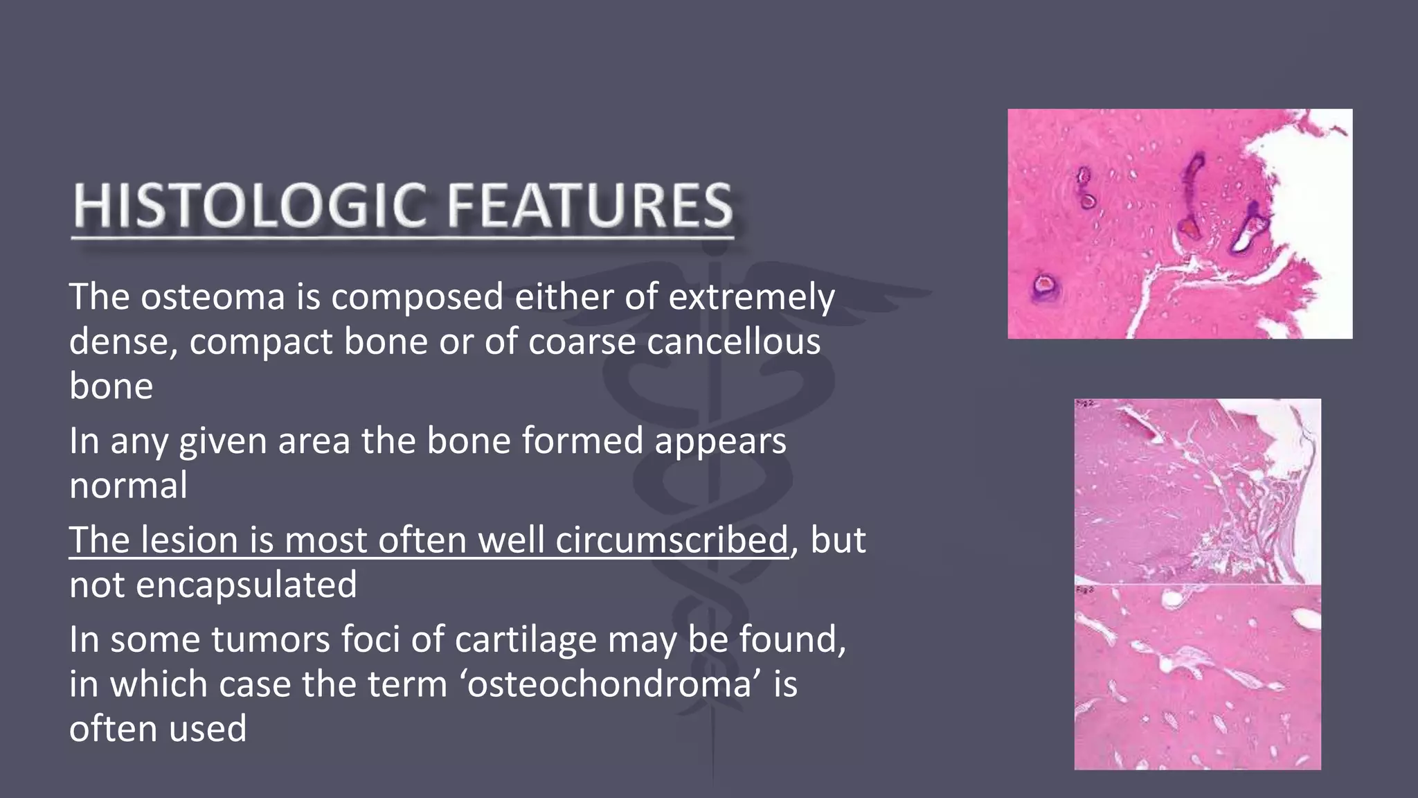 Oral pathology osteoma,chondroma,myxoma | PPTX