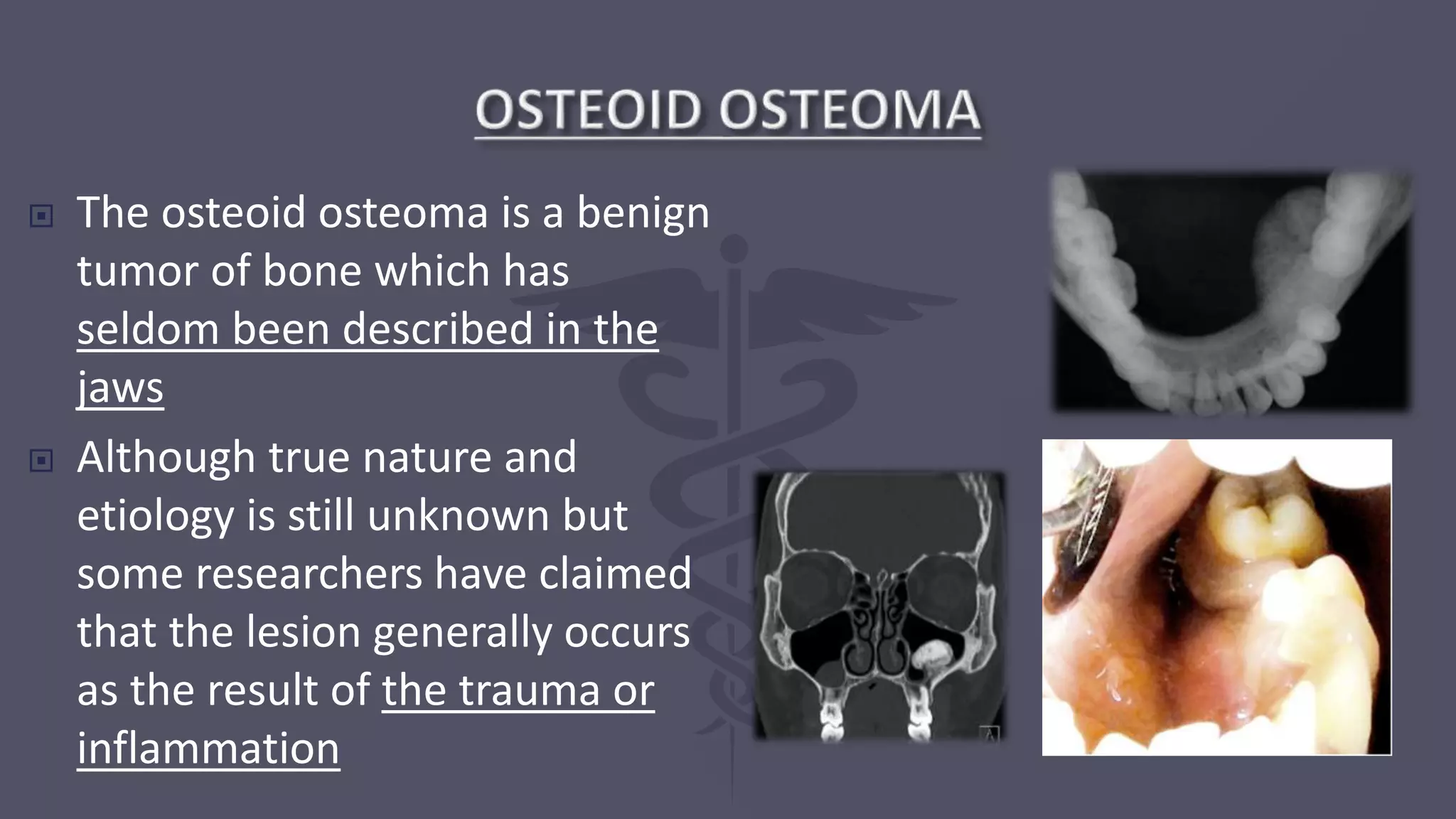 Oral pathology osteoma,chondroma,myxoma | PPTX