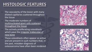 Oral pathology osteoma,chondroma,myxoma | PPTX