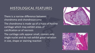 Oral pathology osteoma,chondroma,myxoma | PPTX