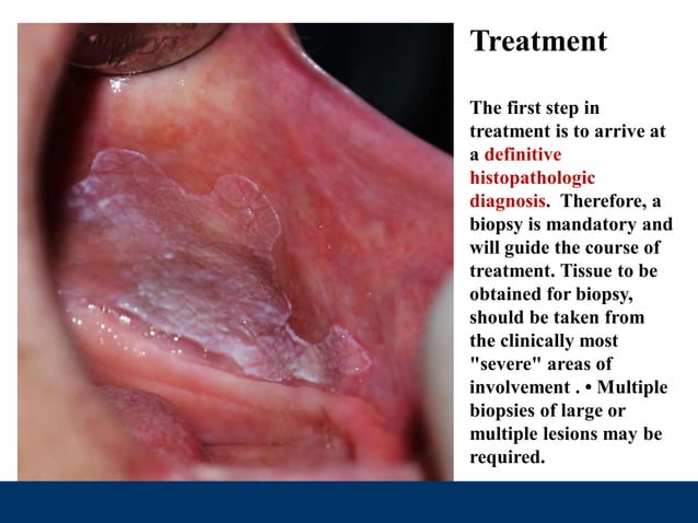 Precancerous Lesions In Oral Cavity Pdf