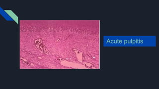 ORAL PATHOLOGY slides.pdf