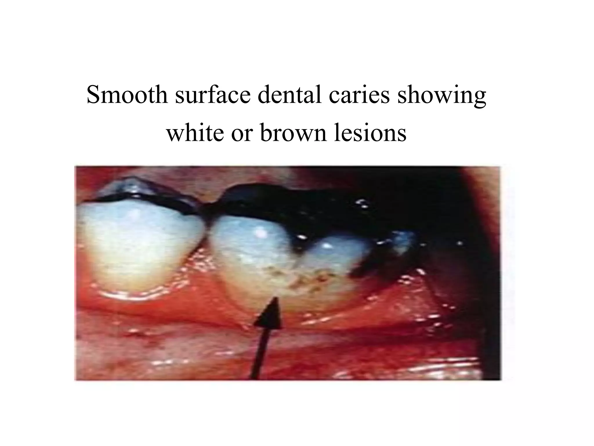 Oral pathology images | PDF