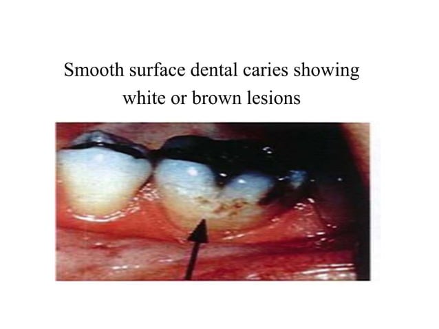 Oral pathology images | PDF