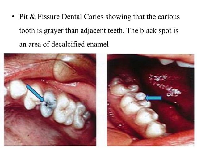 Oral pathology images | PDF