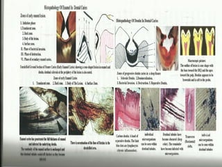 Oral pathology images | PDF