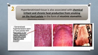 Oral pathology, lecture 1 | PPTX