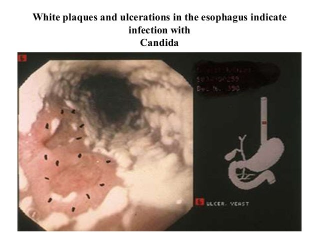 Oral Pathology and Oesophagus