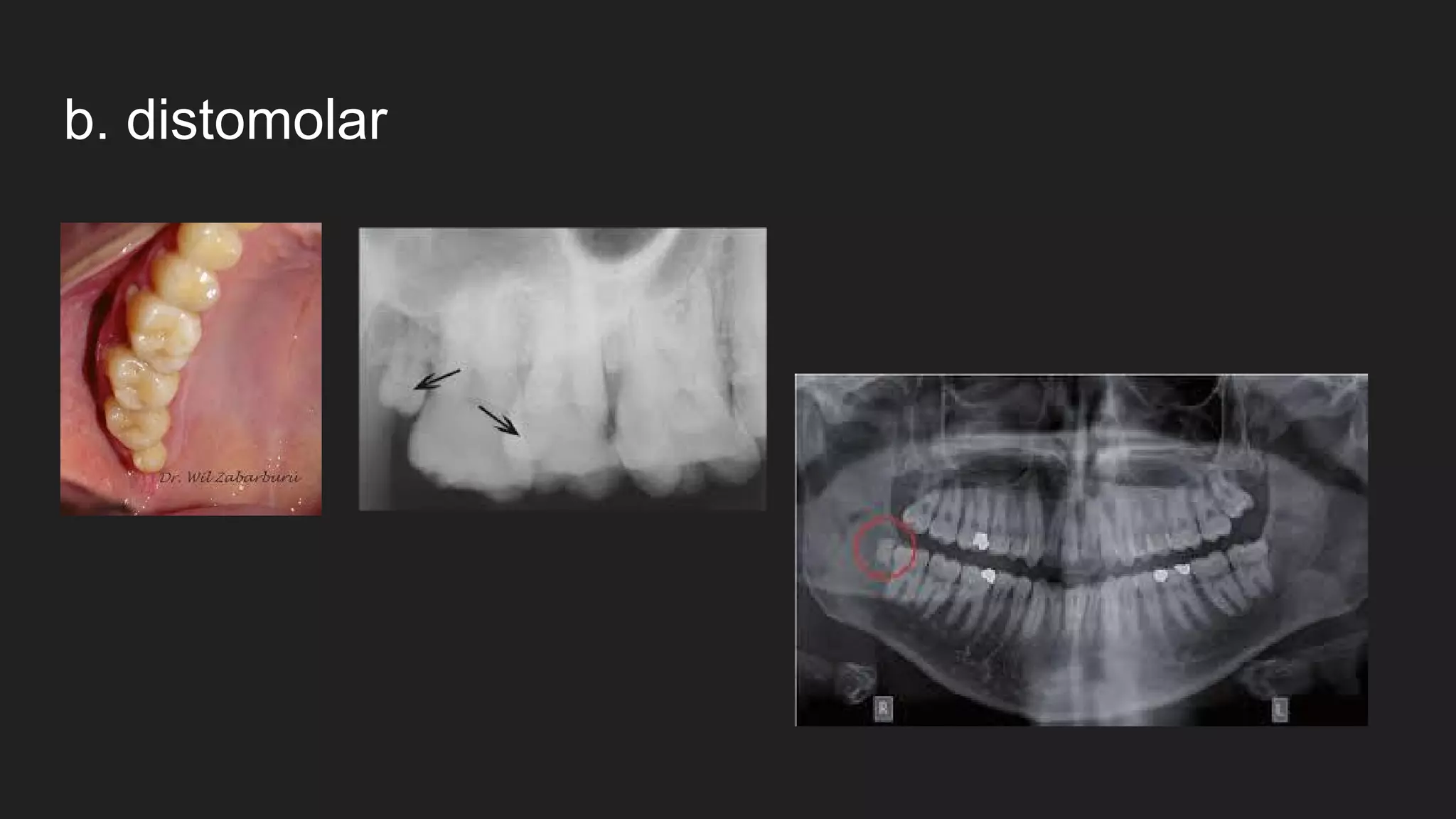 Developmental disorders of teeth and related tissues. | PPT | Free Download