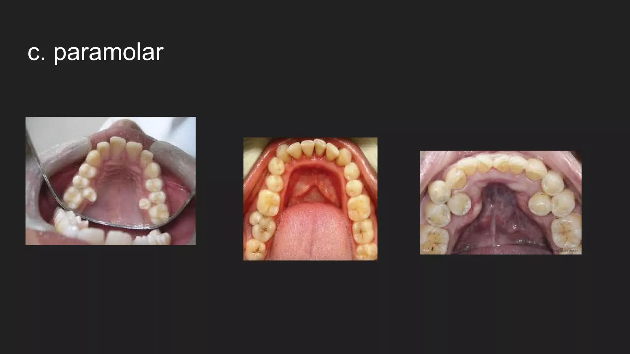 Developmental disorders of teeth and related tissues. | PPT | Free Download