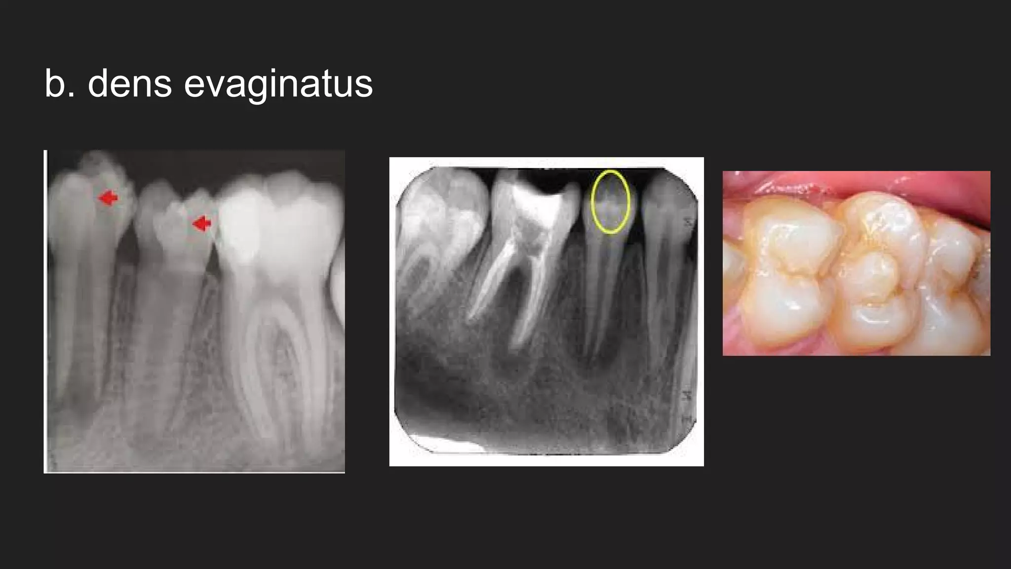 Developmental disorders of teeth and related tissues. | PPT | Free Download