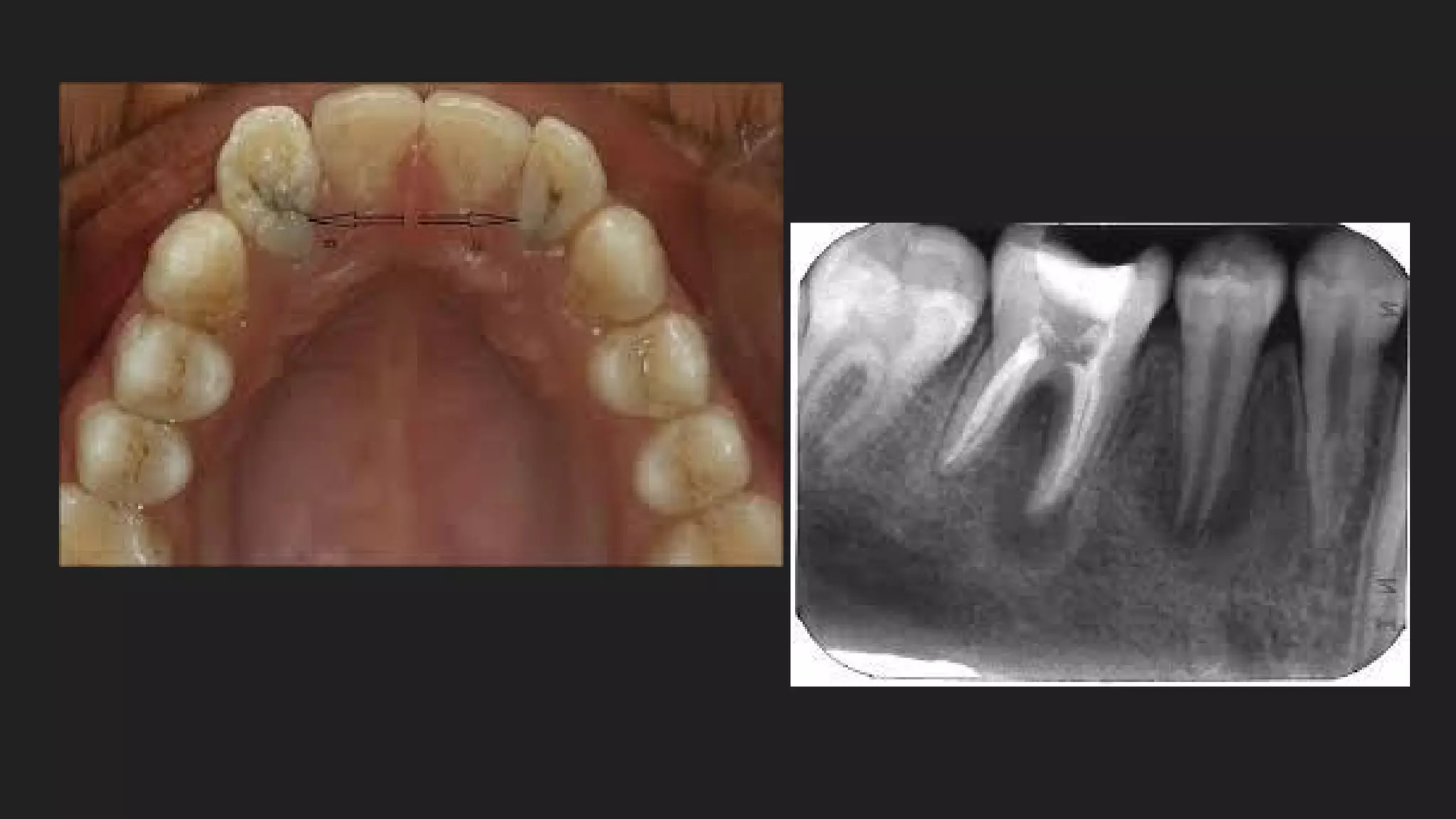 Developmental disorders of teeth and related tissues. | PPT | Free Download