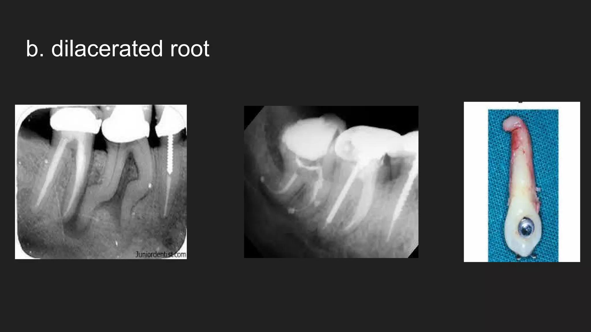 Developmental disorders of teeth and related tissues. | PPT | Free Download