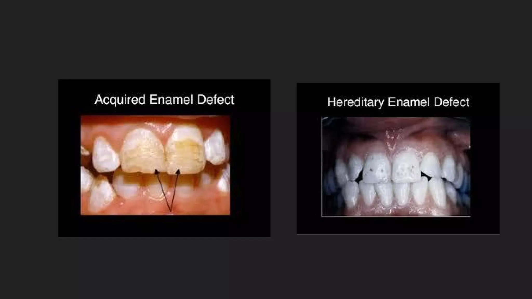 Developmental disorders of teeth and related tissues. | PPT | Free Download