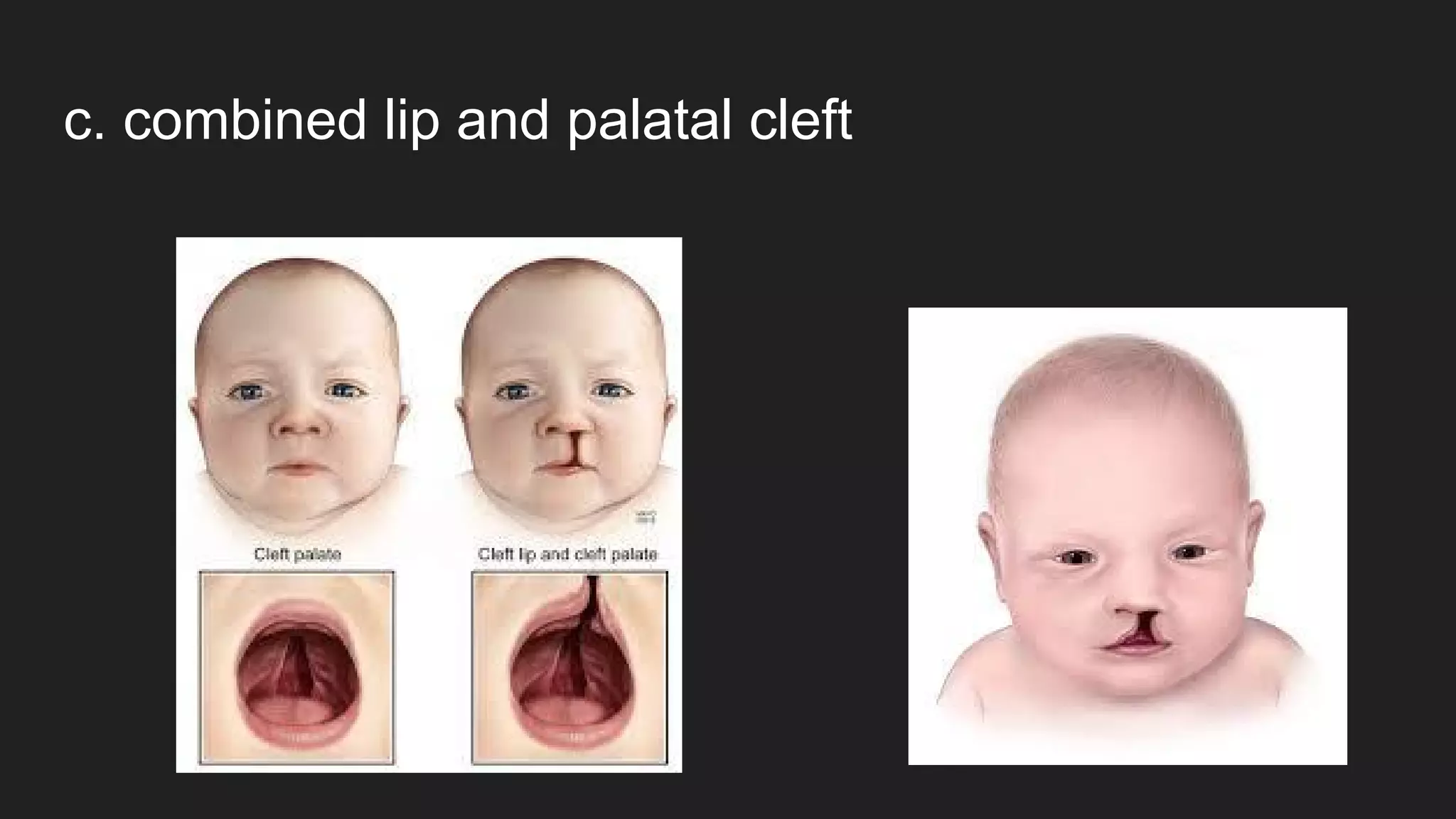 Developmental disorders of teeth and related tissues. | PPT | Free Download