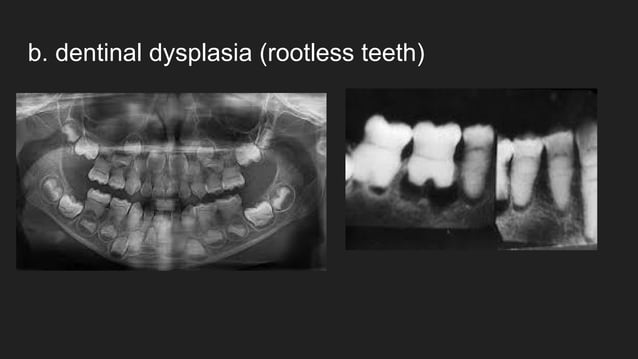 Developmental disorders of teeth and related tissues. | PPT | Free Download