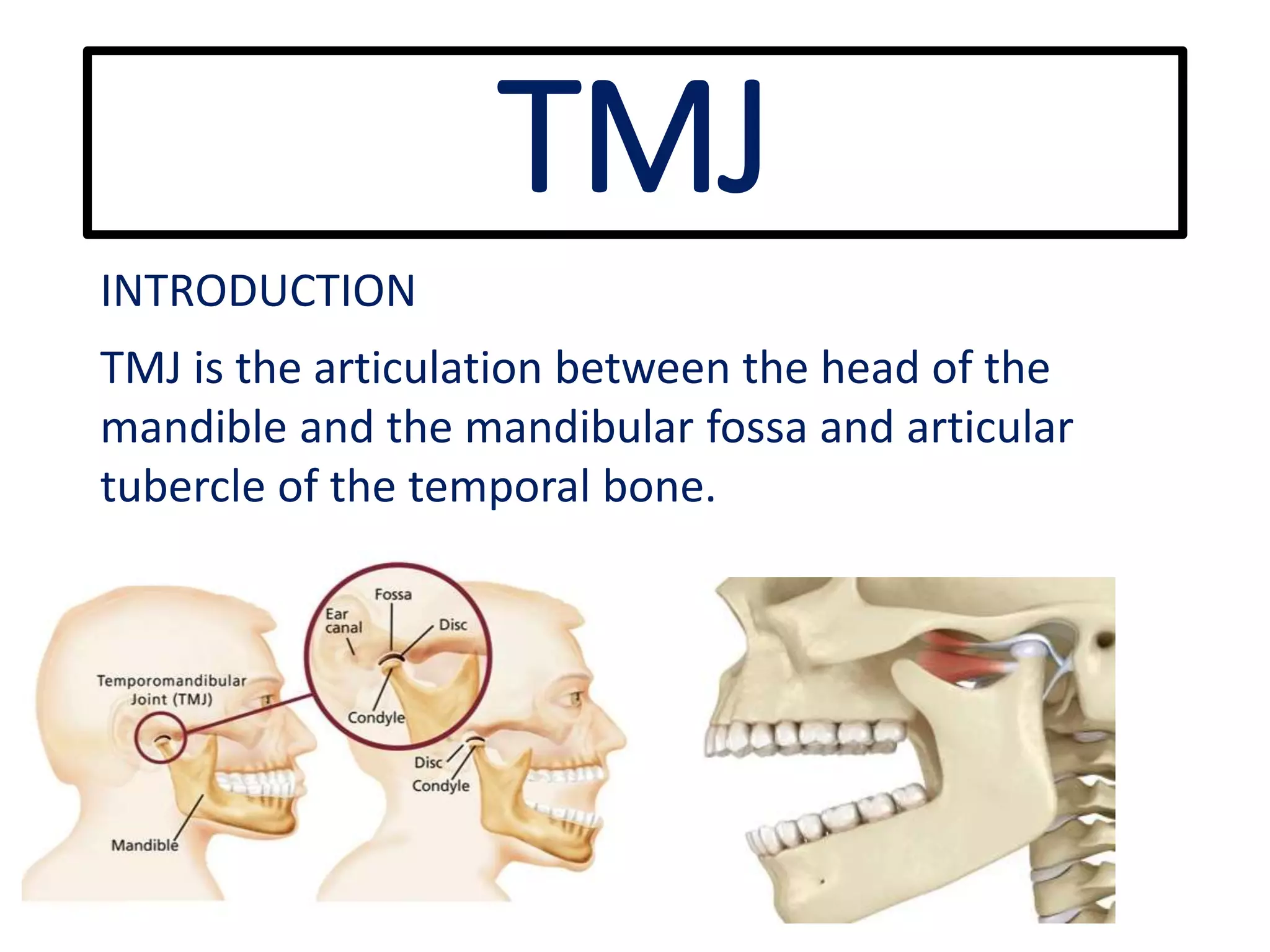 Temporomandibular joint Disorder in oral pathology | PPTX