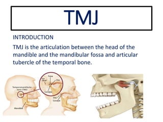 Temporomandibular joint Disorder in oral pathology | PPTX | Death ...