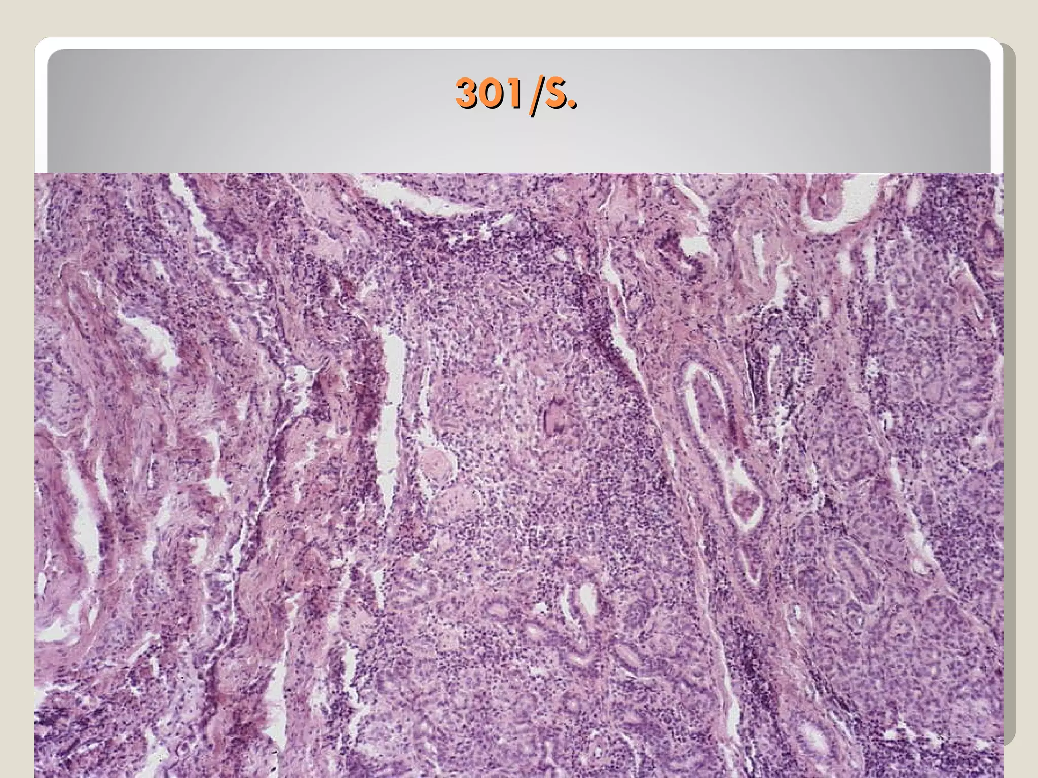Oral+pathology+salivary+glands+pathology | PPT