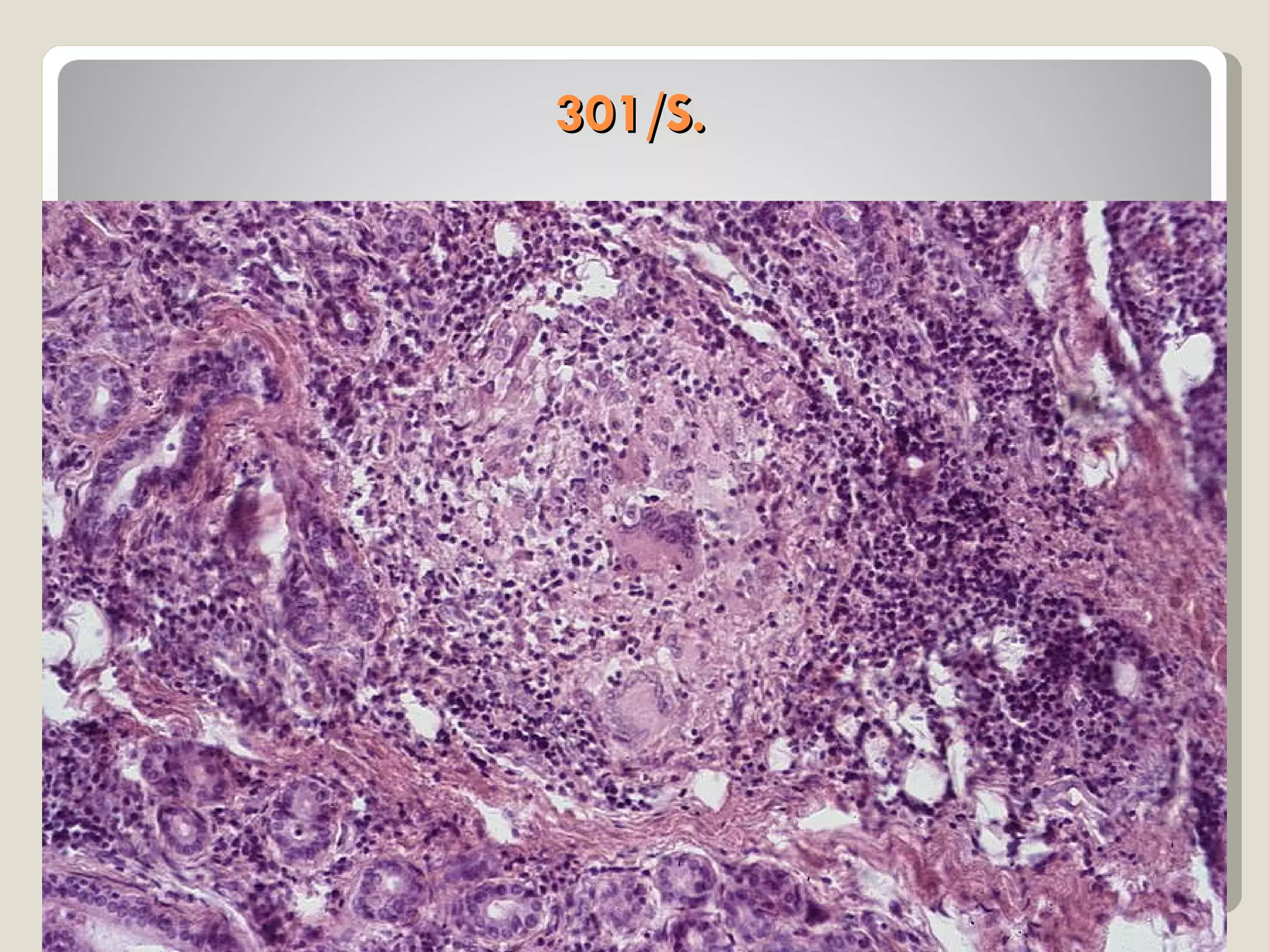 Oral+pathology+salivary+glands+pathology | PPT