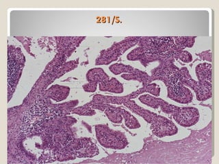 Oral+pathology+salivary+glands+pathology | PPT