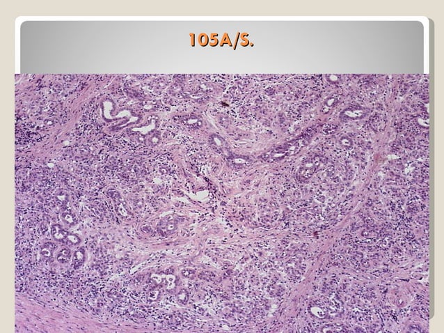Oral+pathology+salivary+glands+pathology | PPT