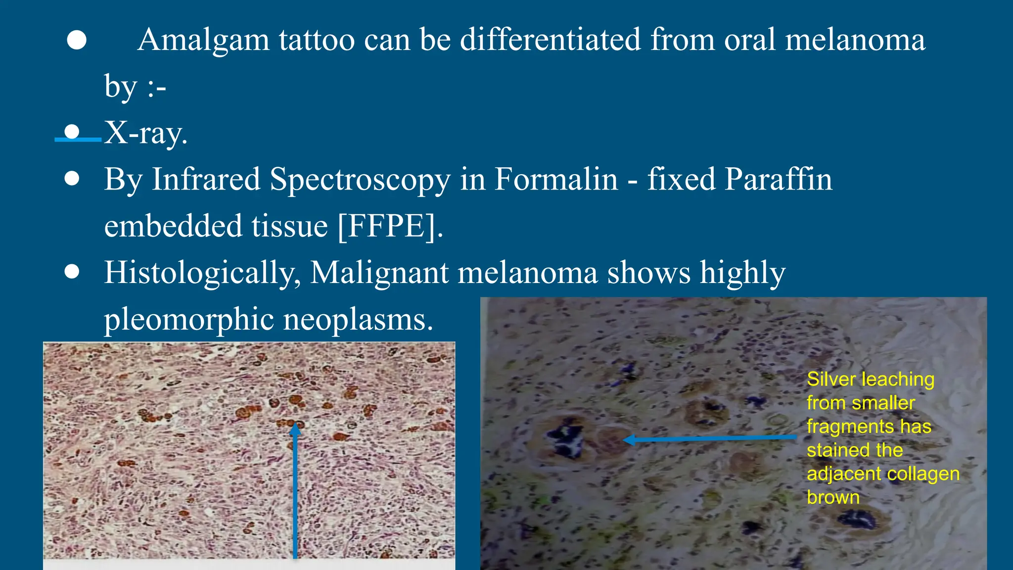 ORAL PATHOLOGY SEMINAR REDO-2.pptxORAL PATHOLOGY SEMINAR REDO-2.pptx