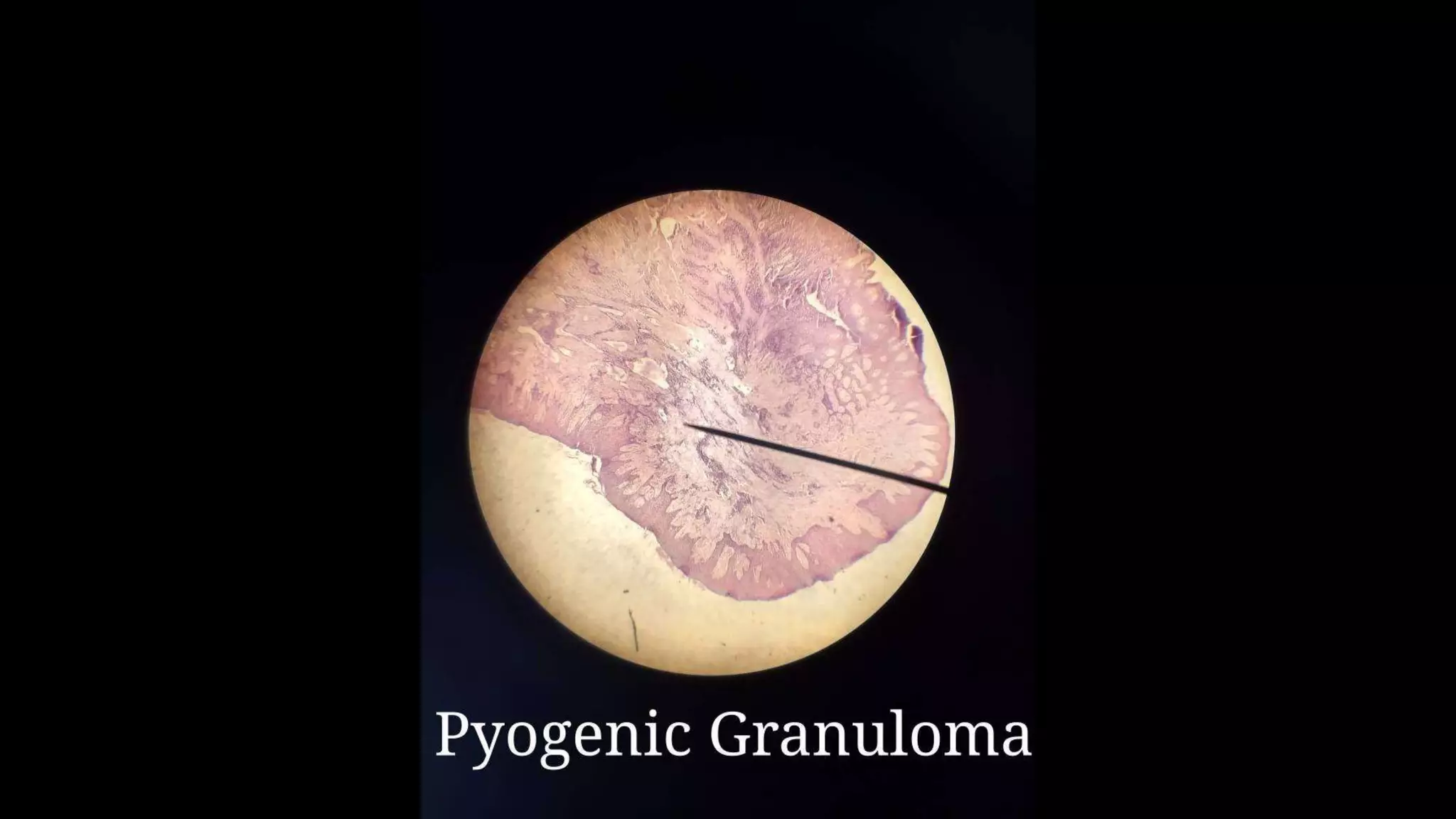Oral pathology histology slide | PPT