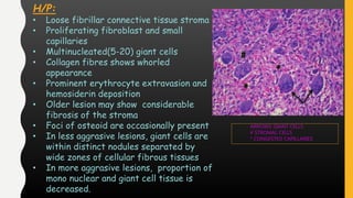 Central Giant Cell Granuloma Histology