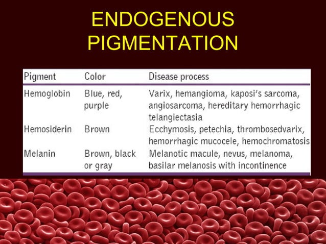 Oral pigmentation lesion | PPT | Skin and Dermatology | Diseases and ...