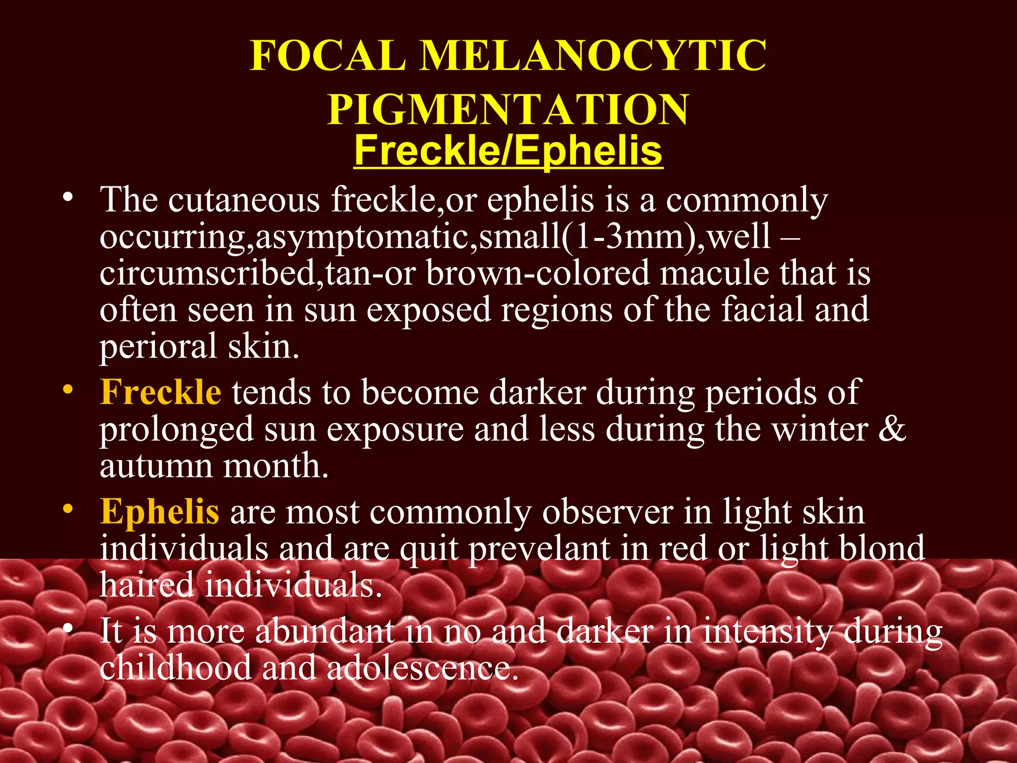 Oral pigmentation lesion | PPT