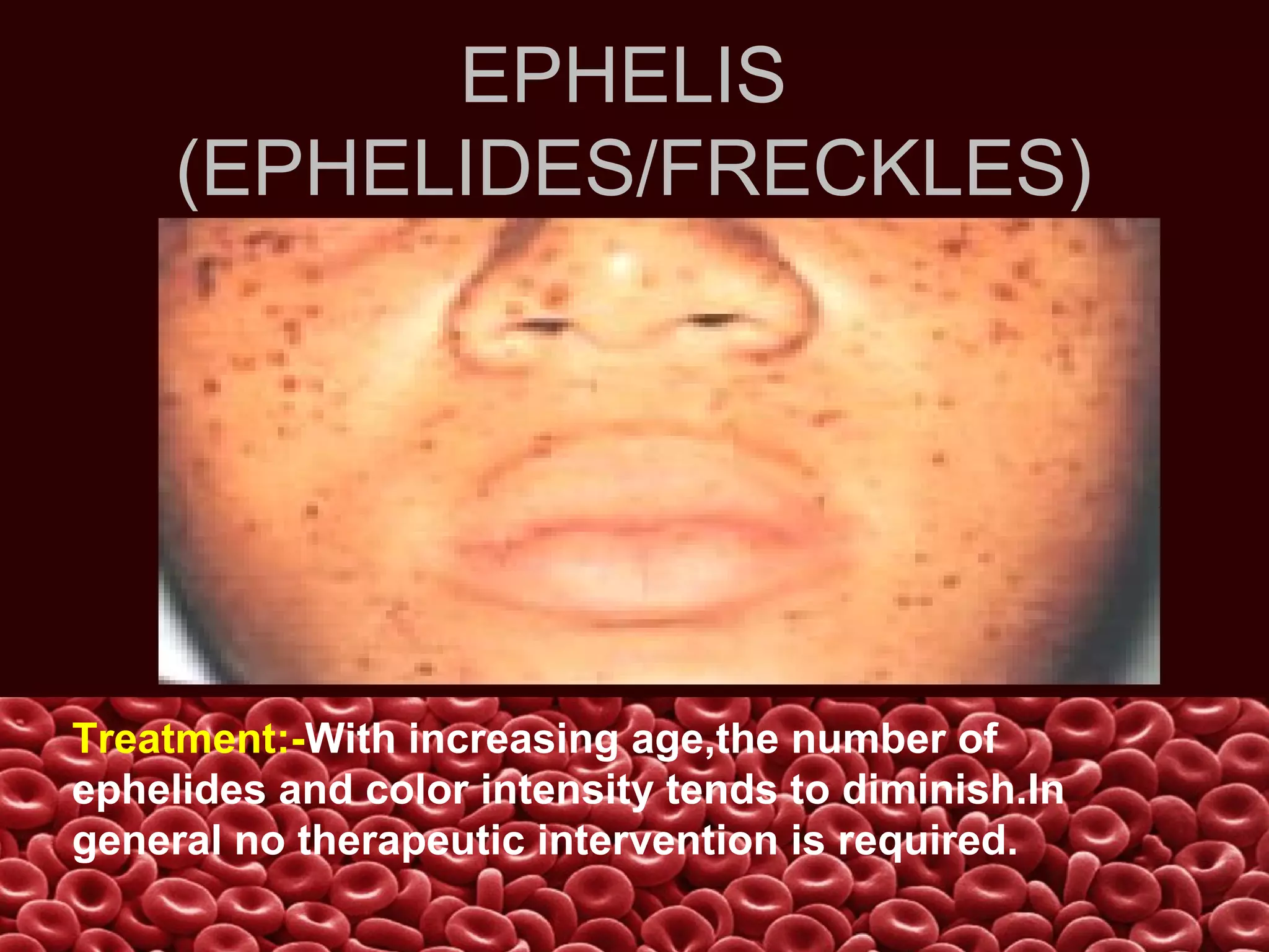 Oral pigmentation lesion | PPT