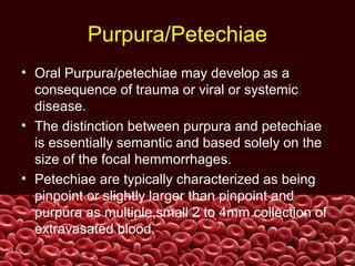 Oral pigmentation lesion | PPT