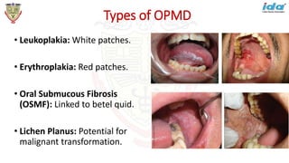 Oral Potentially Malignant Disorders - editedpptx.pptx