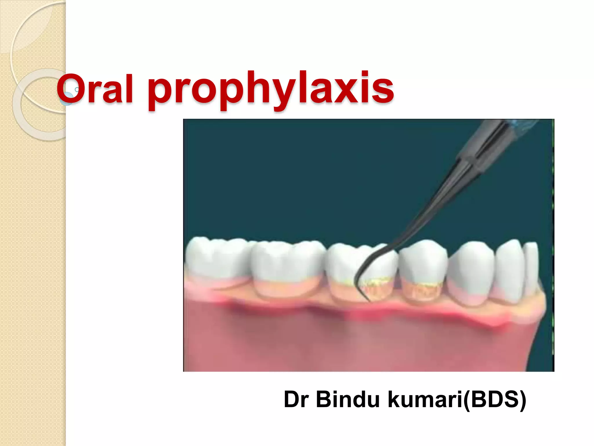 Oral prophylaxis | PPTX