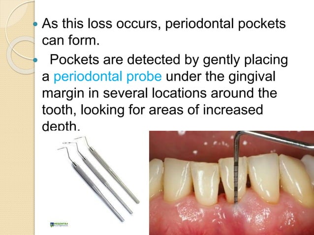 Oral prophylaxis | PPTX