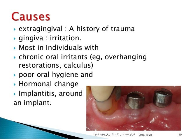 Oral pyogenic granuloma