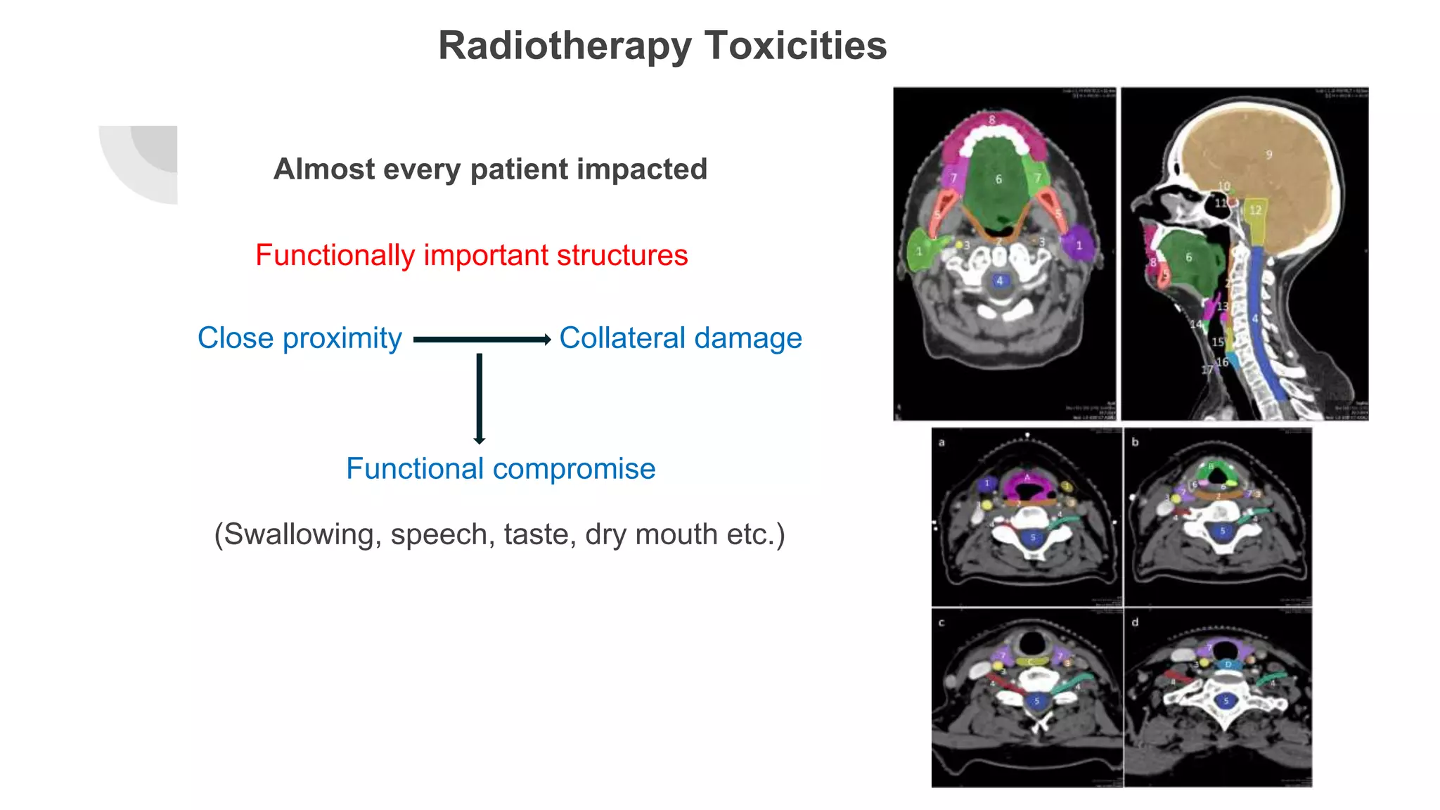 Oral Radiation Toxicity.pptx