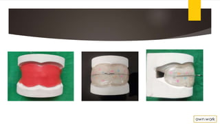 ORAL SCREEN in ortho patients- a case report | PPTX