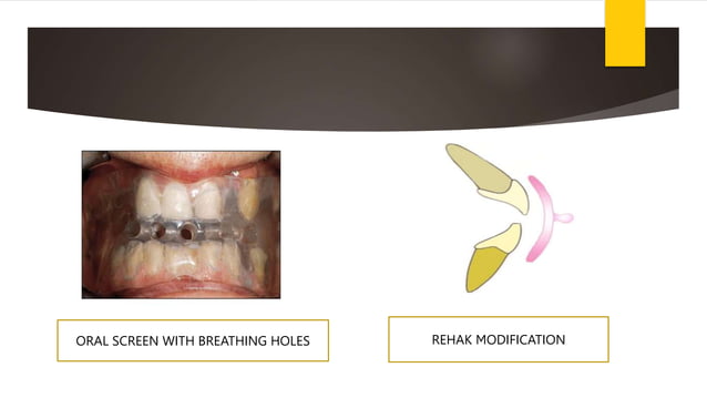 ORAL SCREEN in ortho patients- a case report | PPTX